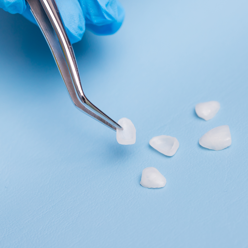 Cosmetic Procedures – Vivid Dental