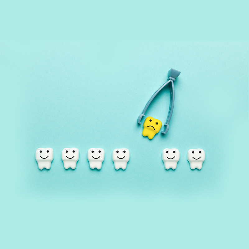 Tooth Extractions – Vivid Dental